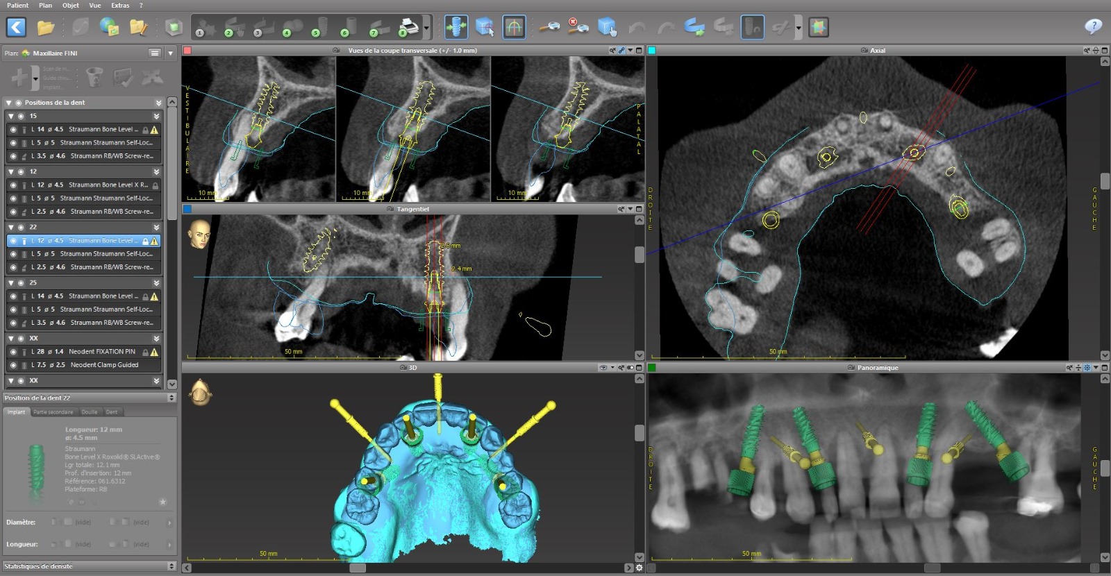 design4me - modelisations 3d de prothèses dentaires pour laboratoires ...
