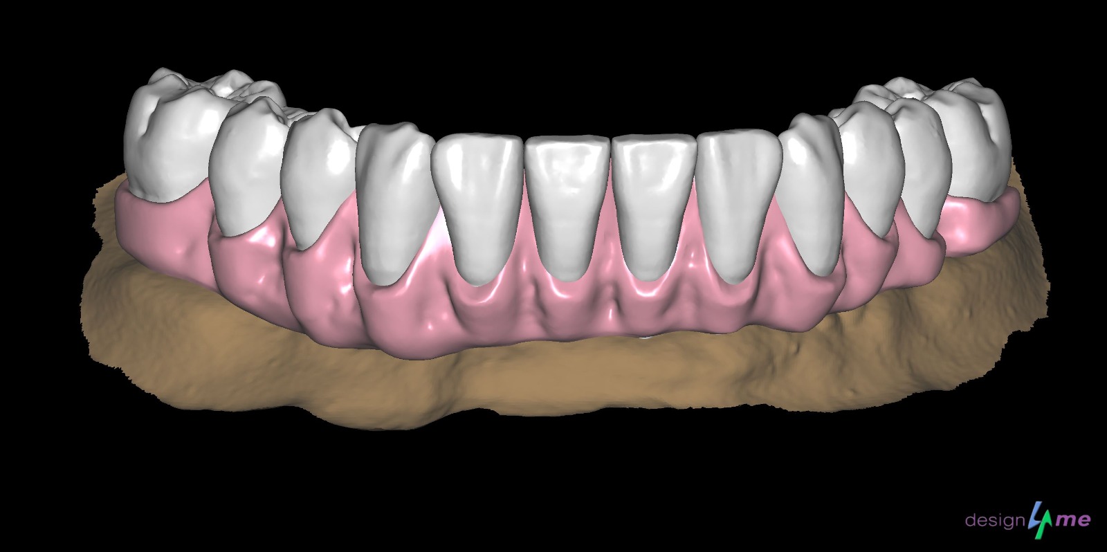 design4me - modelisations 3d de prothèses dentaires pour laboratoires ...